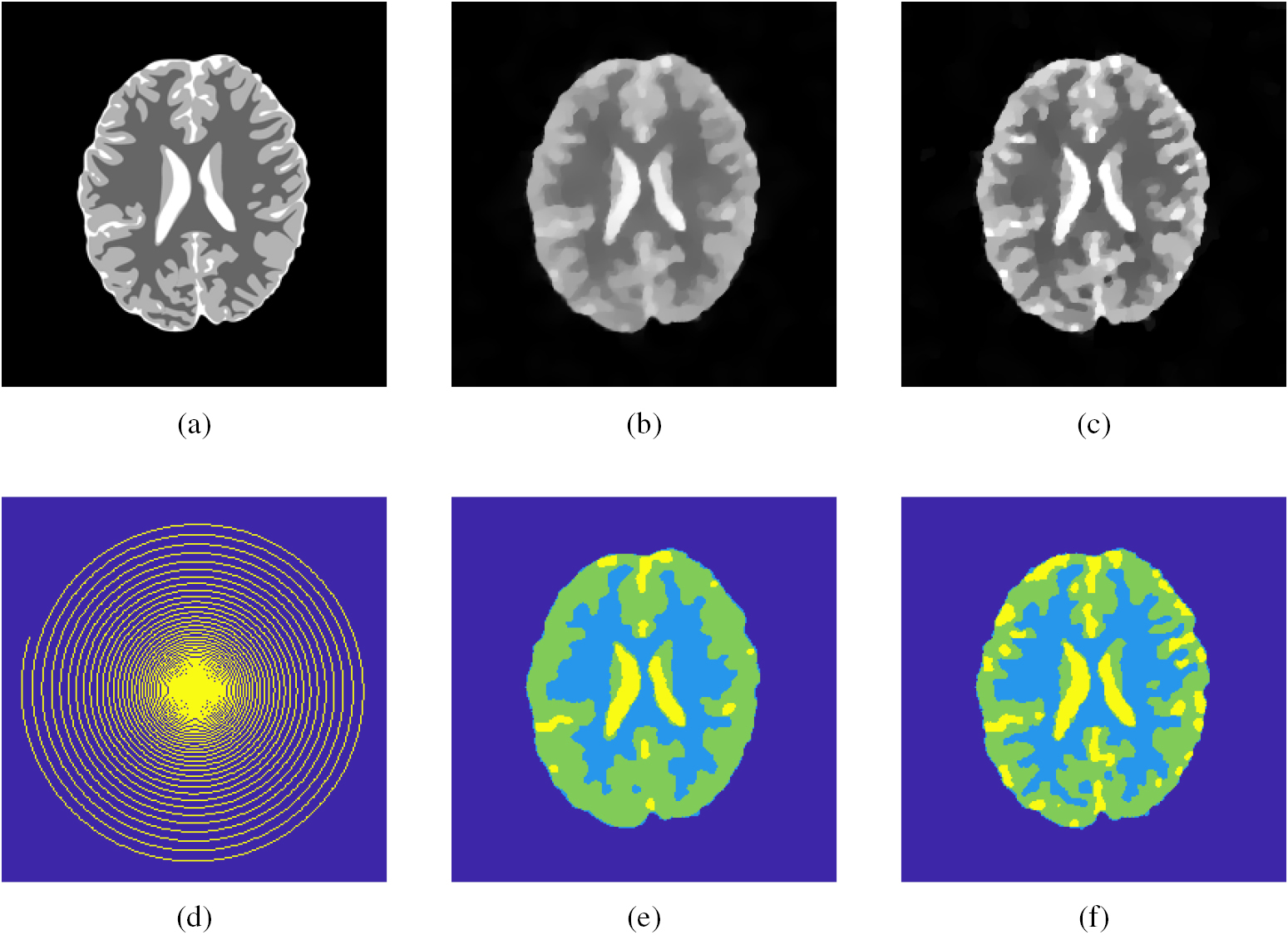 Enhancing joint reconstruction and segmentation with non-convex Bregman iteration - IOPscience