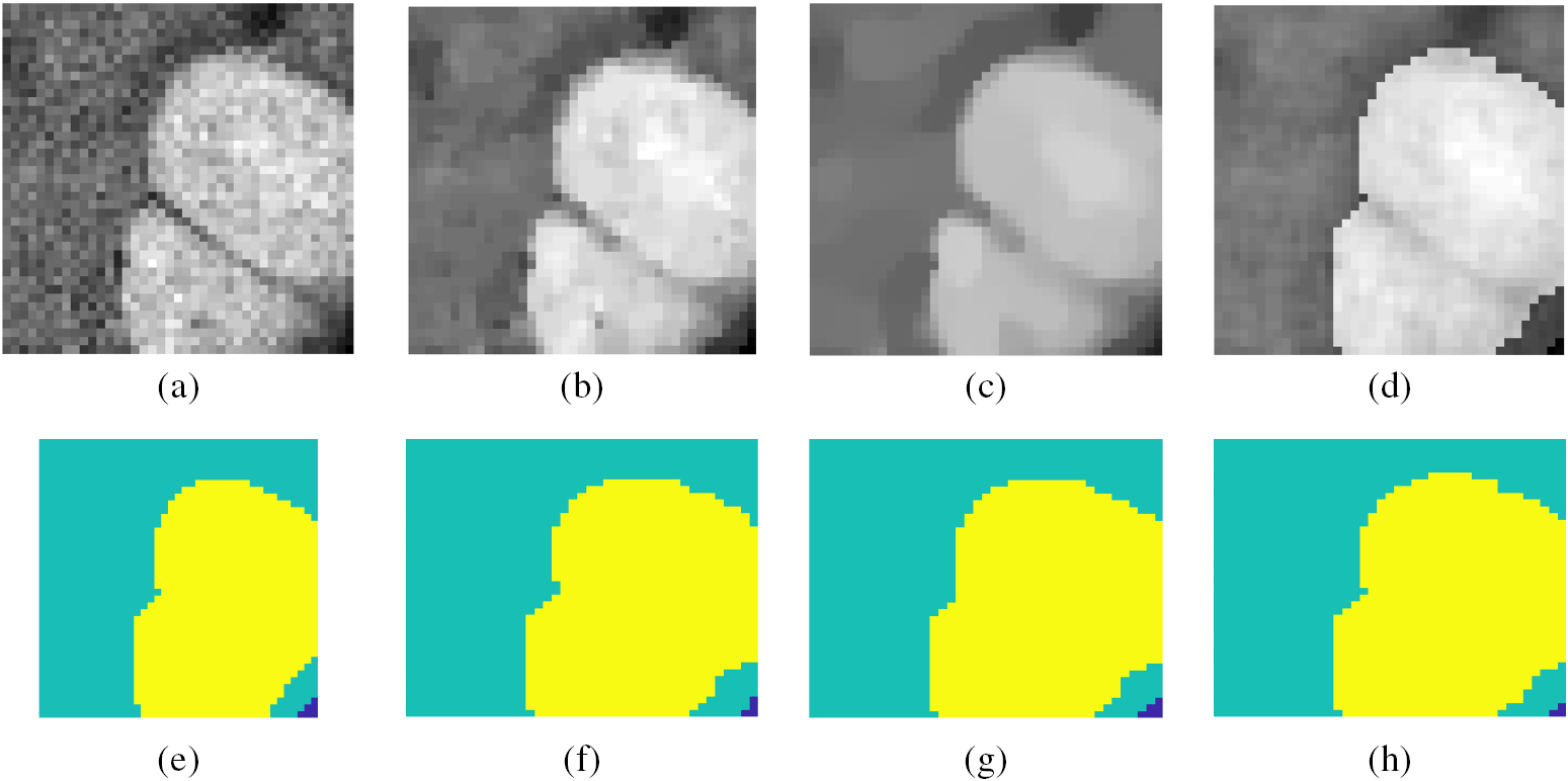 Enhancing joint reconstruction and segmentation with non-convex Bregman iteration - IOPscience