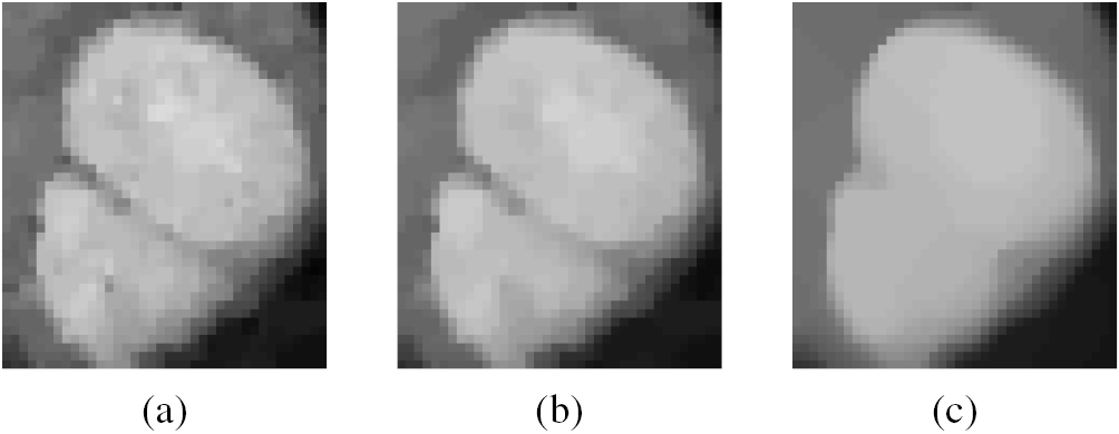Enhancing joint reconstruction and segmentation with non-convex Bregman iteration - IOPscience