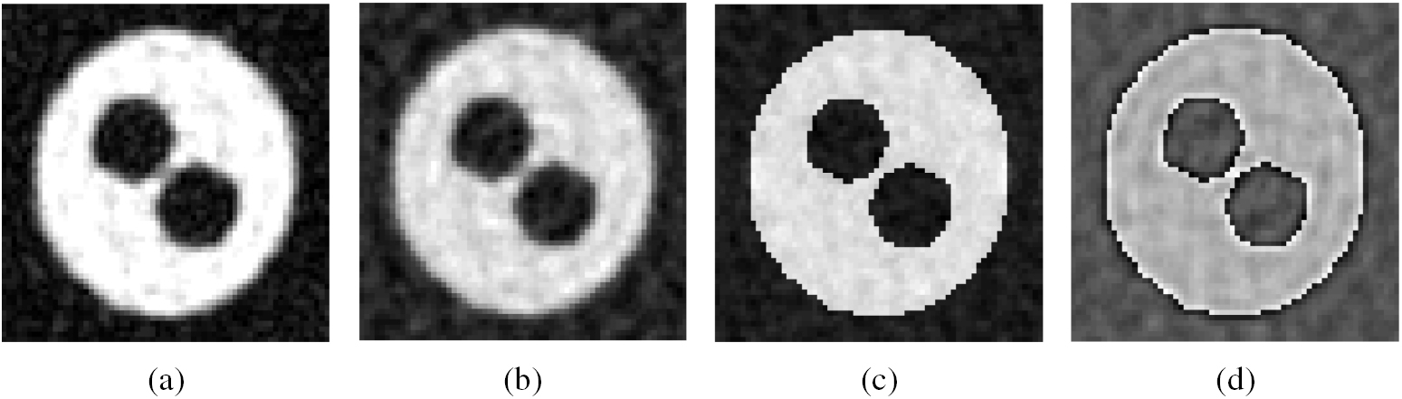 Enhancing joint reconstruction and segmentation with non-convex Bregman iteration - IOPscience
