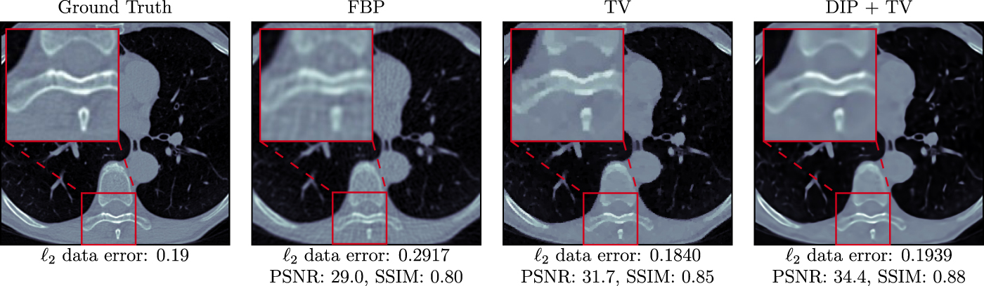 Computed tomography reconstruction using deep image prior and learned ...