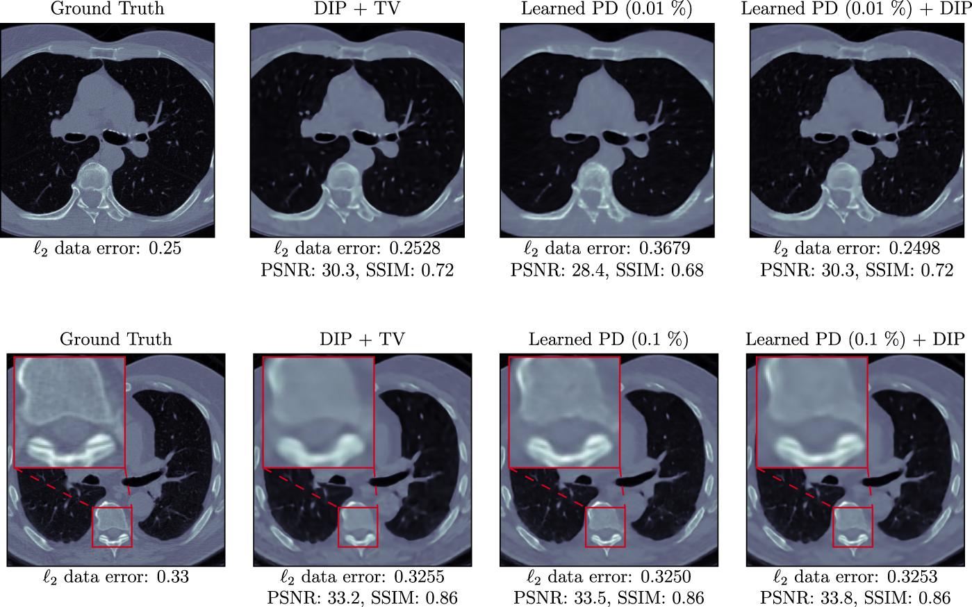 Computed tomography reconstruction using deep image prior and learned ...