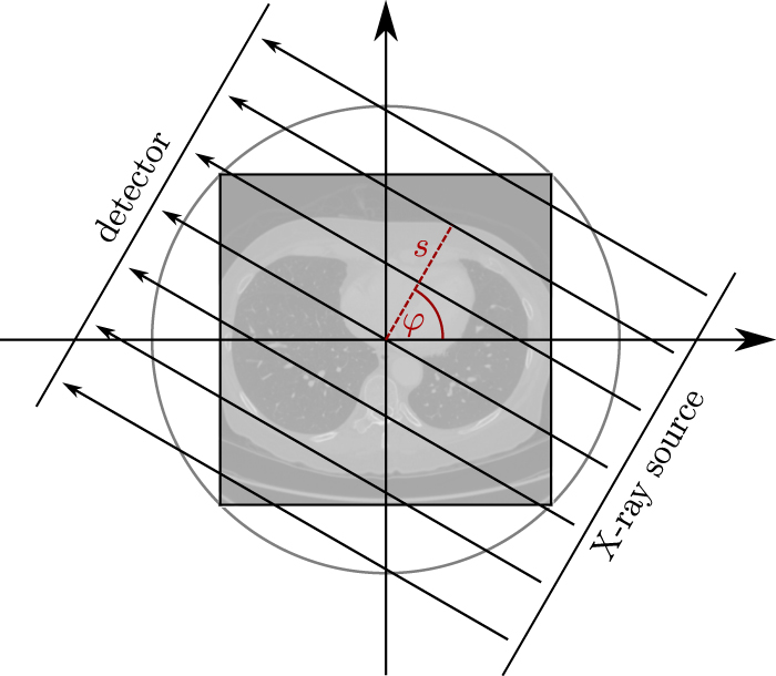 Computed tomography reconstruction using deep image prior and learned ...