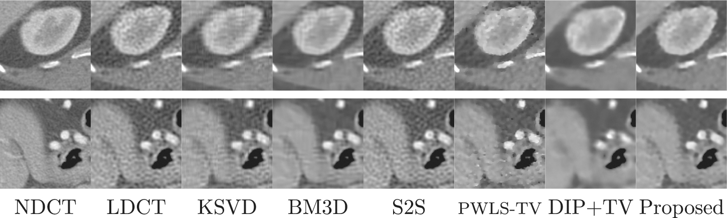 A dataset-free deep learning method for low-dose CT image reconstruction - IOPscience