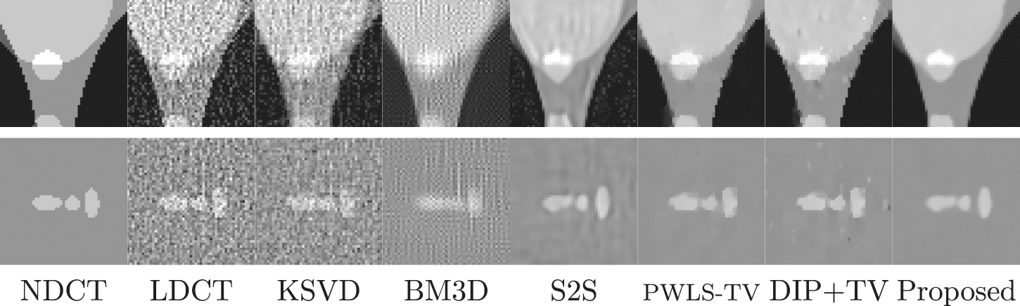 A dataset-free deep learning method for low-dose CT image ...