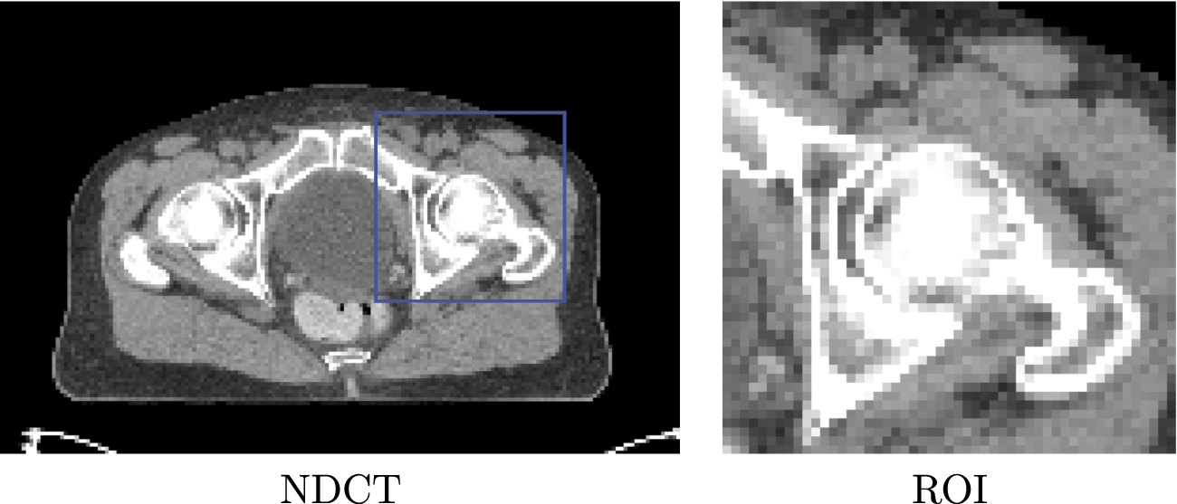 A dataset-free deep learning method for low-dose CT image ...