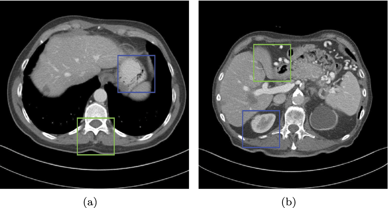 A dataset-free deep learning method for low-dose CT image ...