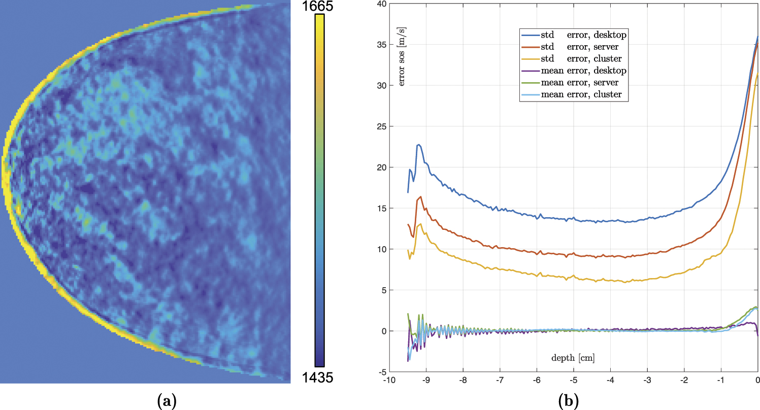 High resolution 3D ultrasonic breast imaging by time-domain full ...
