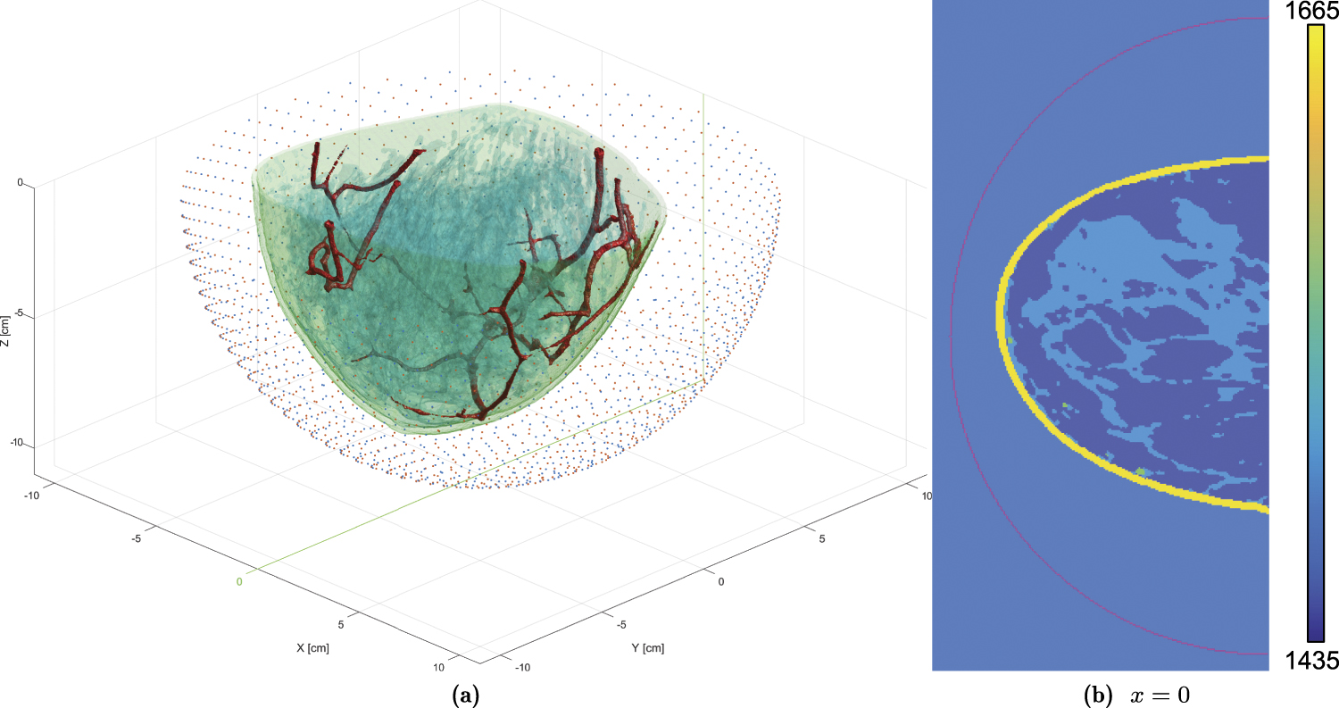 High resolution 3D ultrasonic breast imaging by time-domain full ...