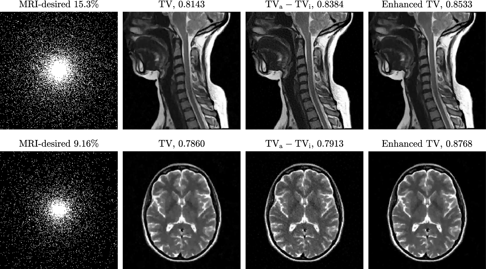 Enhanced total variation minimization for stable image reconstruction ...