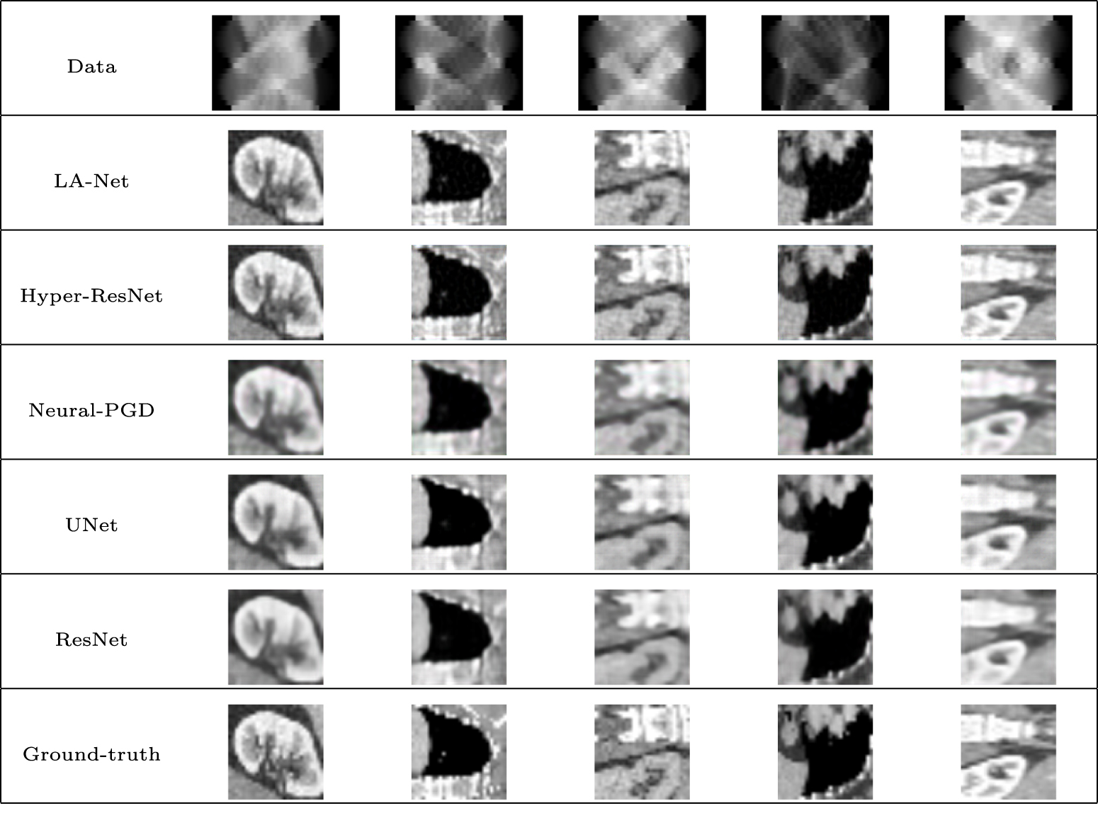 DRIP: deep regularizers for inverse problems - IOPscience
