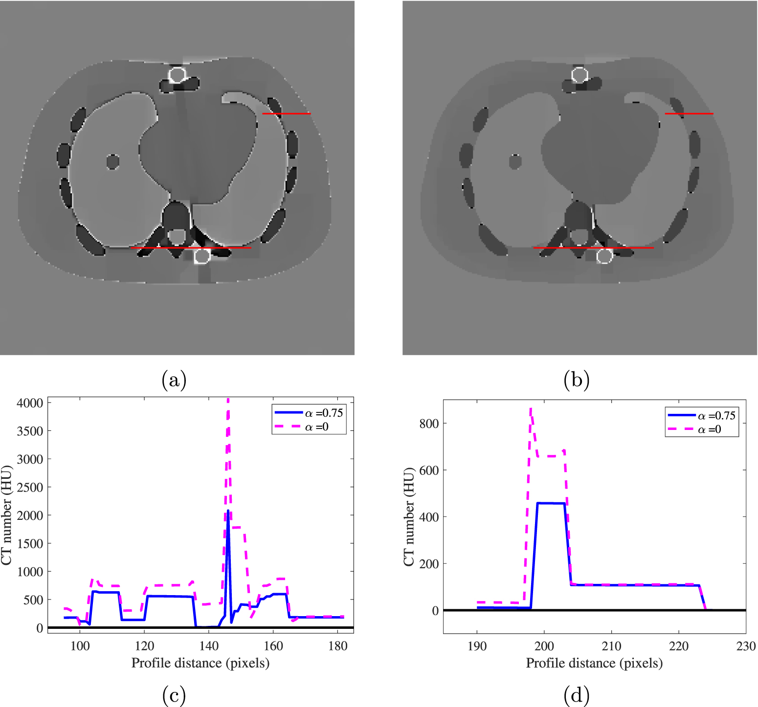 Nonconvex weighted variational metal artifacts removal via convergent primal-dual algorithms ...