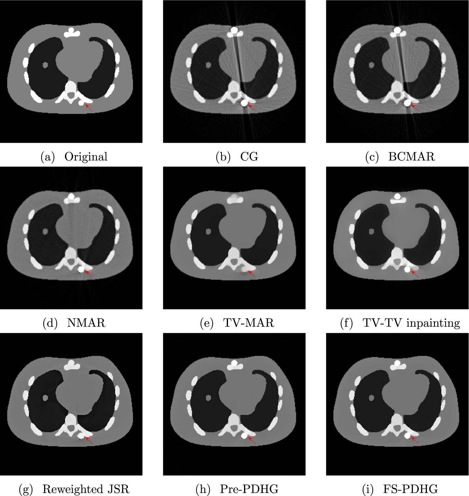Nonconvex weighted variational metal artifacts removal via convergent primal-dual algorithms ...