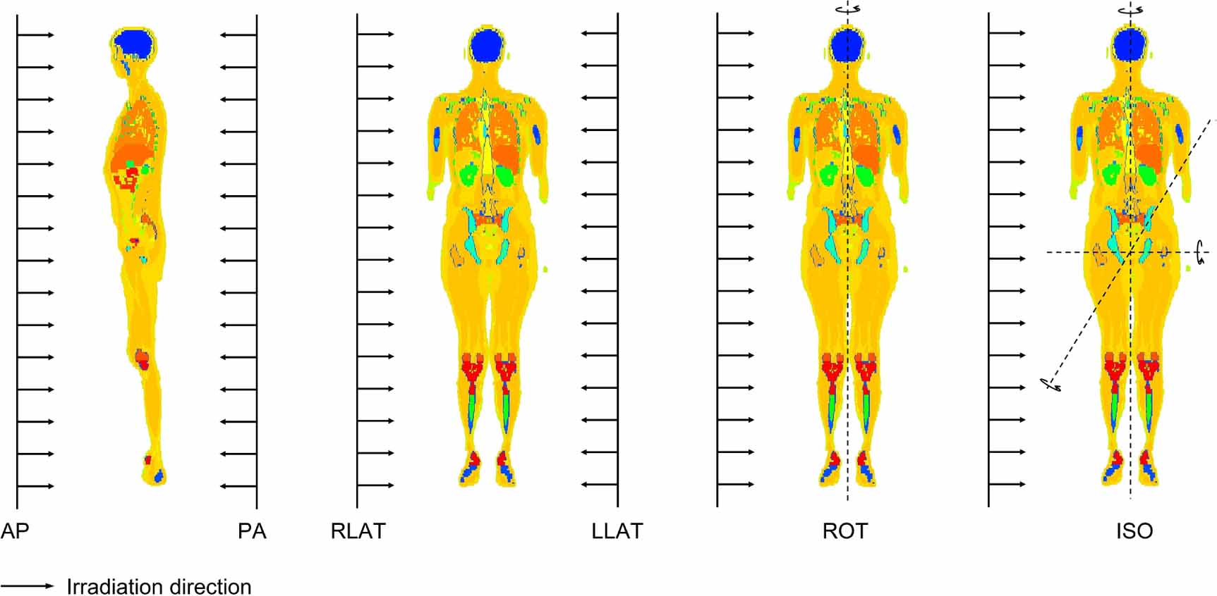 An optimized method for neutron dose evaluation based on 24Na activity ...