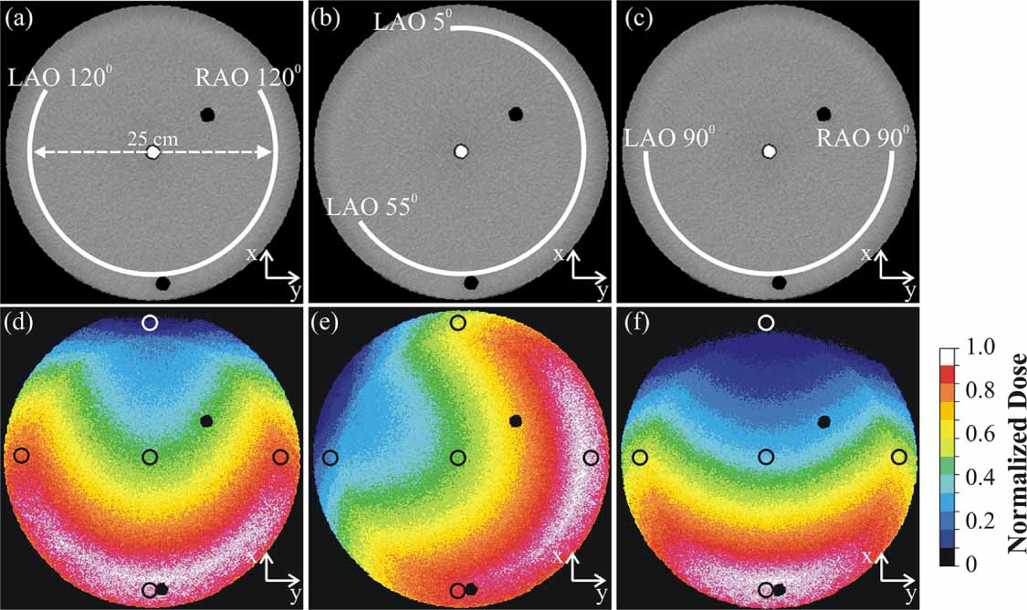 Implementation and evaluation of the AAPM TG 111 for radiation ...