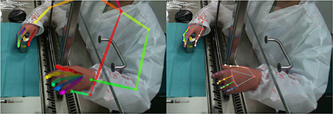 Object and person tracking systems to enable extremity dosimetry in ...