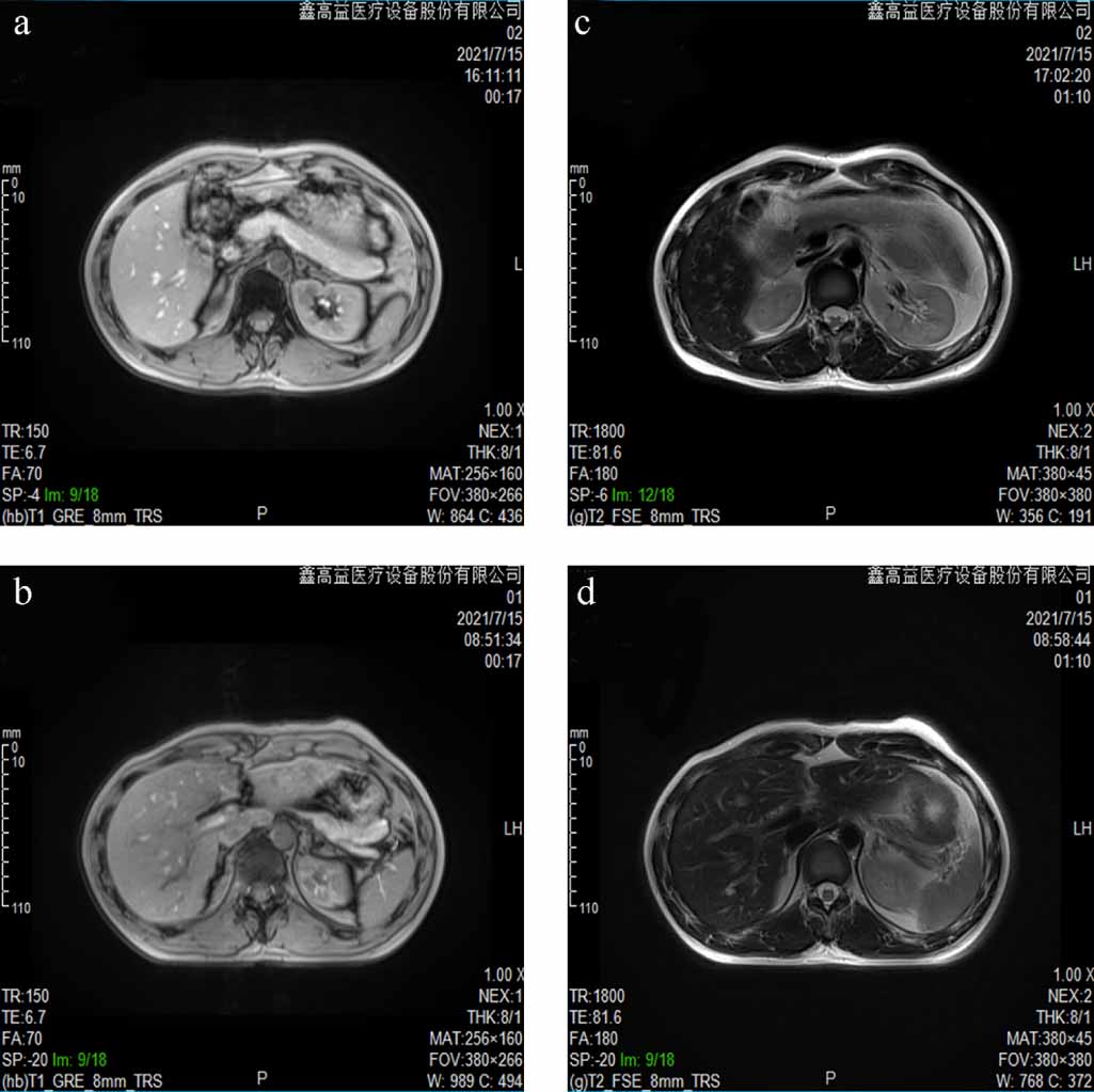 Design, construction and performance testing of a 1.5 T cryogen-free ...