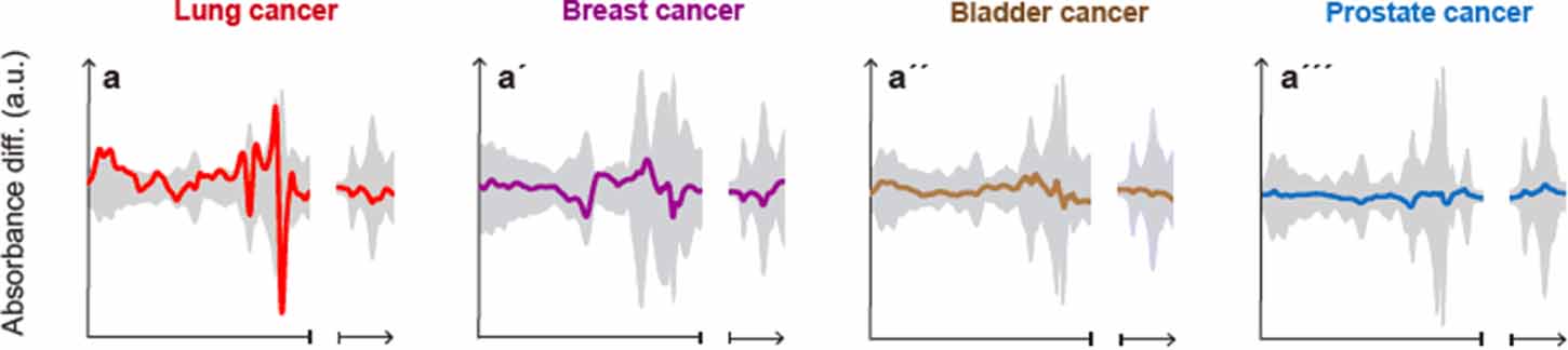 What future for attophysics? - IOPscience