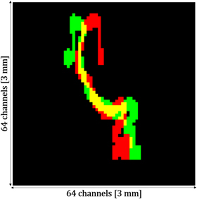 Optimization of convolutional neural networks for background ...