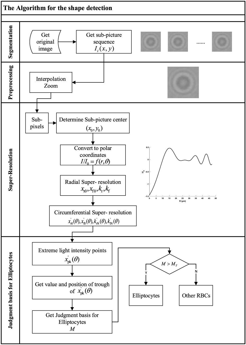 Elliptocyte detection technology based on super-resolution algorithms ...