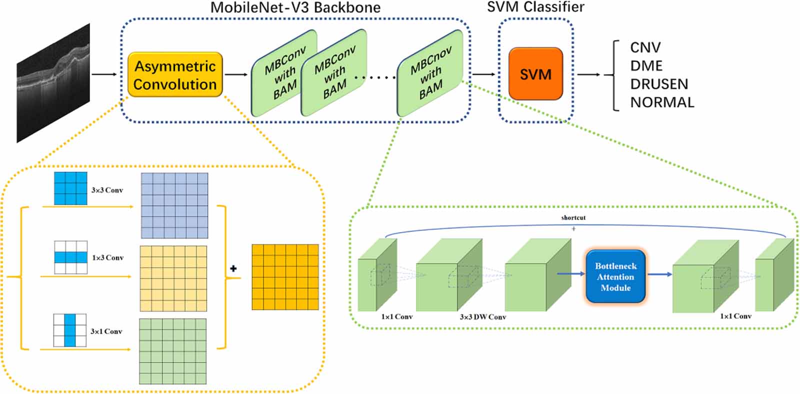 Classification of macular abnormalities using a lightweight CNN-SVM ...
