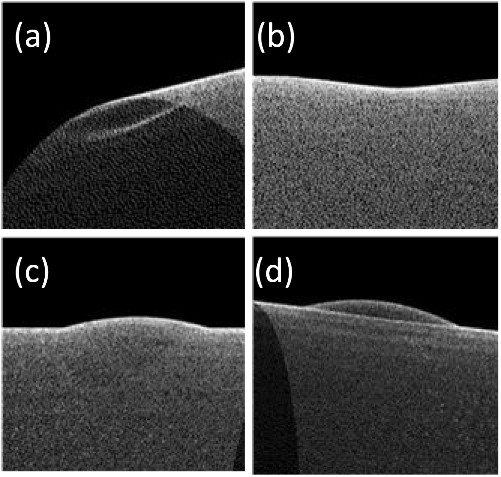 Three-dimensional defects detection of high-voltage cable joint based ...
