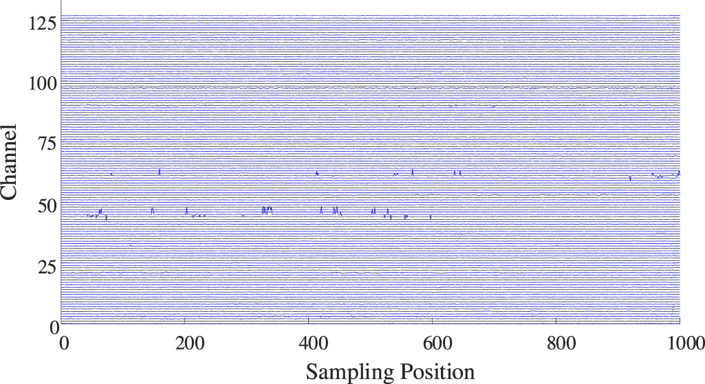 An ultrasonic in-line inspection data processing method considering ...