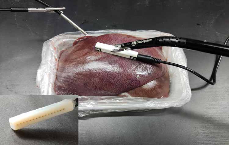 EIT probe based intraoperative tissue inspection for minimally invasive ...