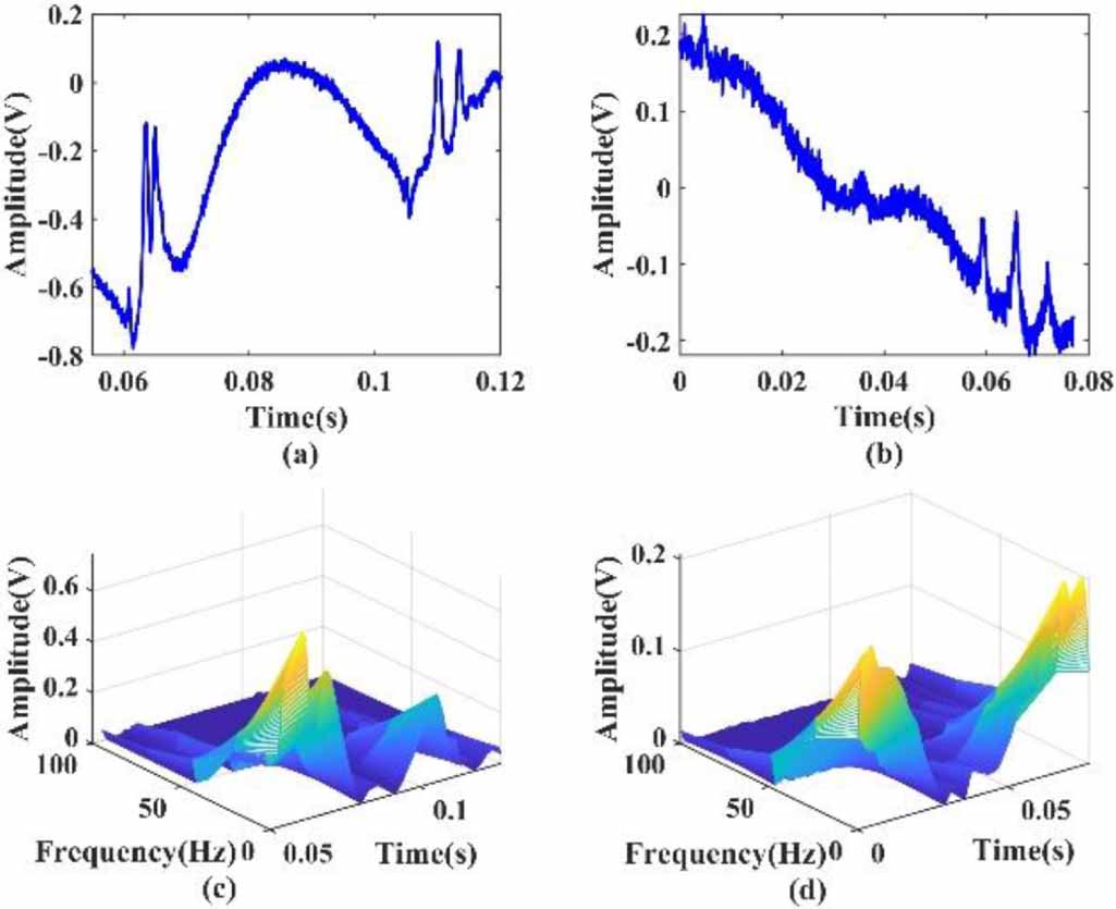 Wavelet-based saturated absorption line detection for laser frequency locking - IOPscience
