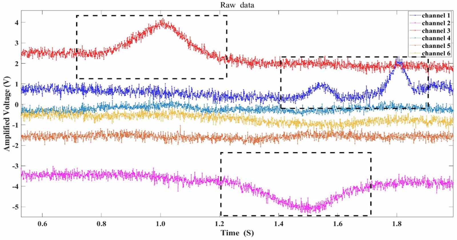 A high-precision TMR sensor array system for detecting surface and ...