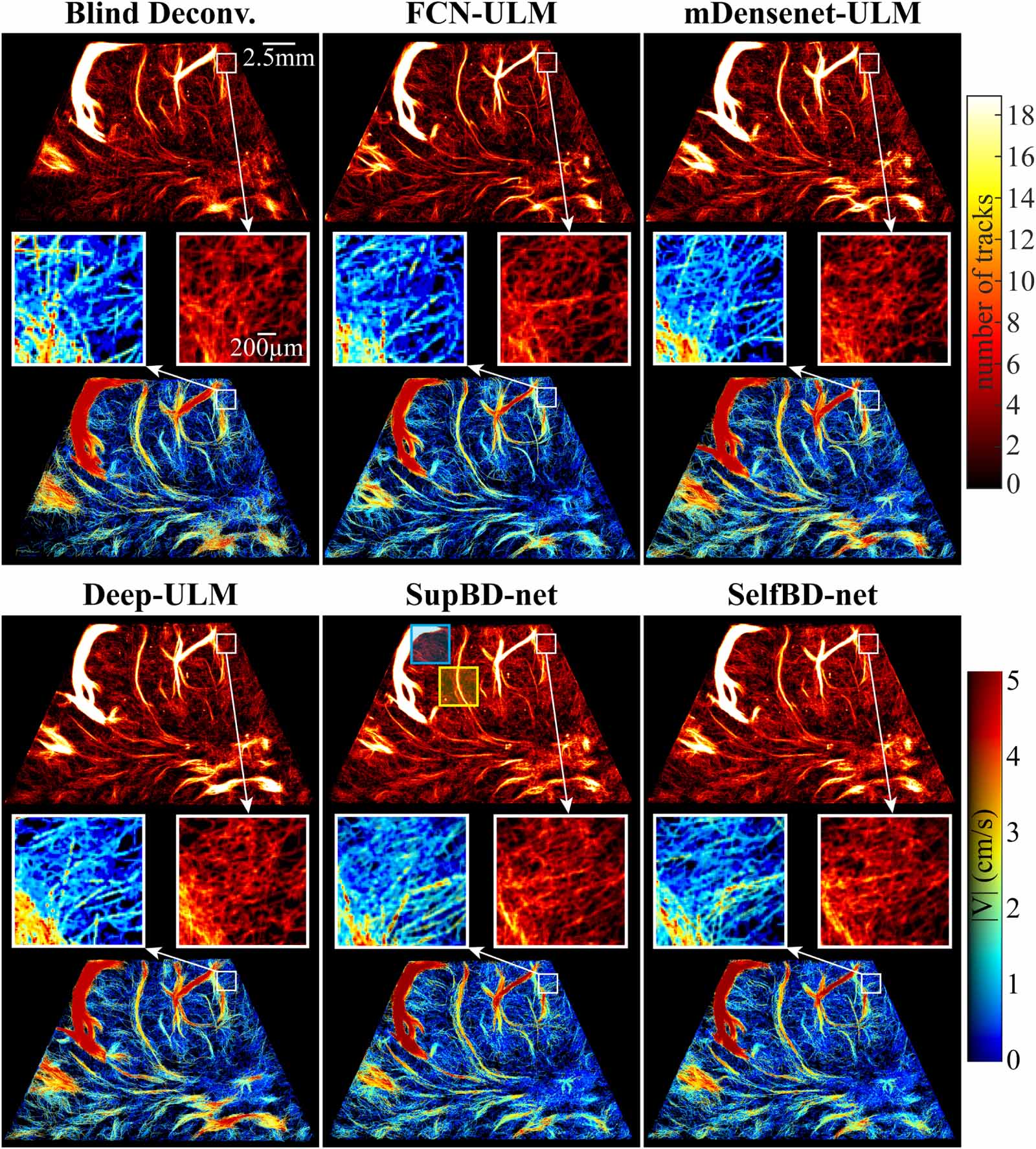 Improving sub-pixel accuracy in ultrasound localization microscopy using supervised and self ...