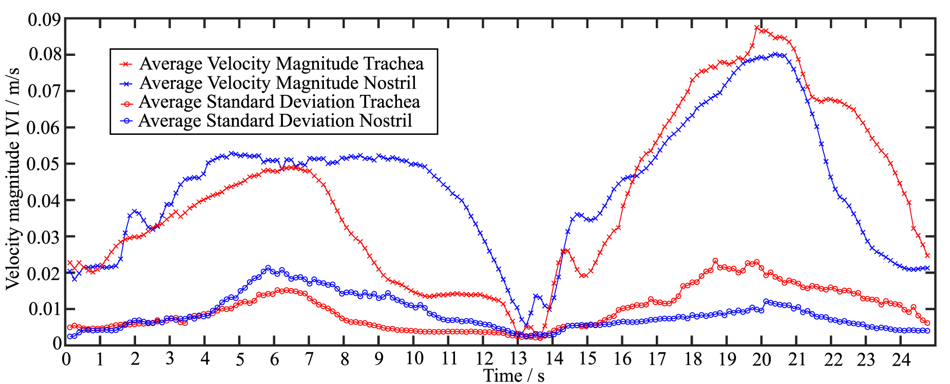 Tomo-PIV in a patient-specific model of human nasal cavities: a ...