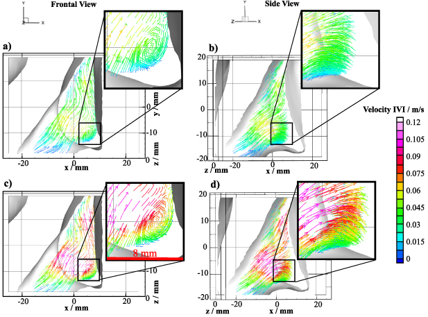 Tomo-PIV in a patient-specific model of human nasal cavities: a ...