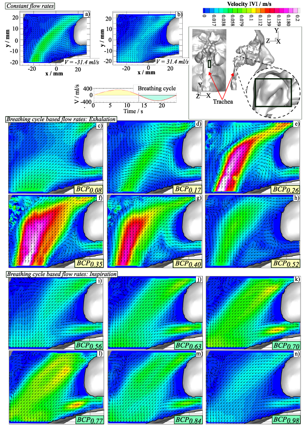 Tomo-PIV in a patient-specific model of human nasal cavities: a ...