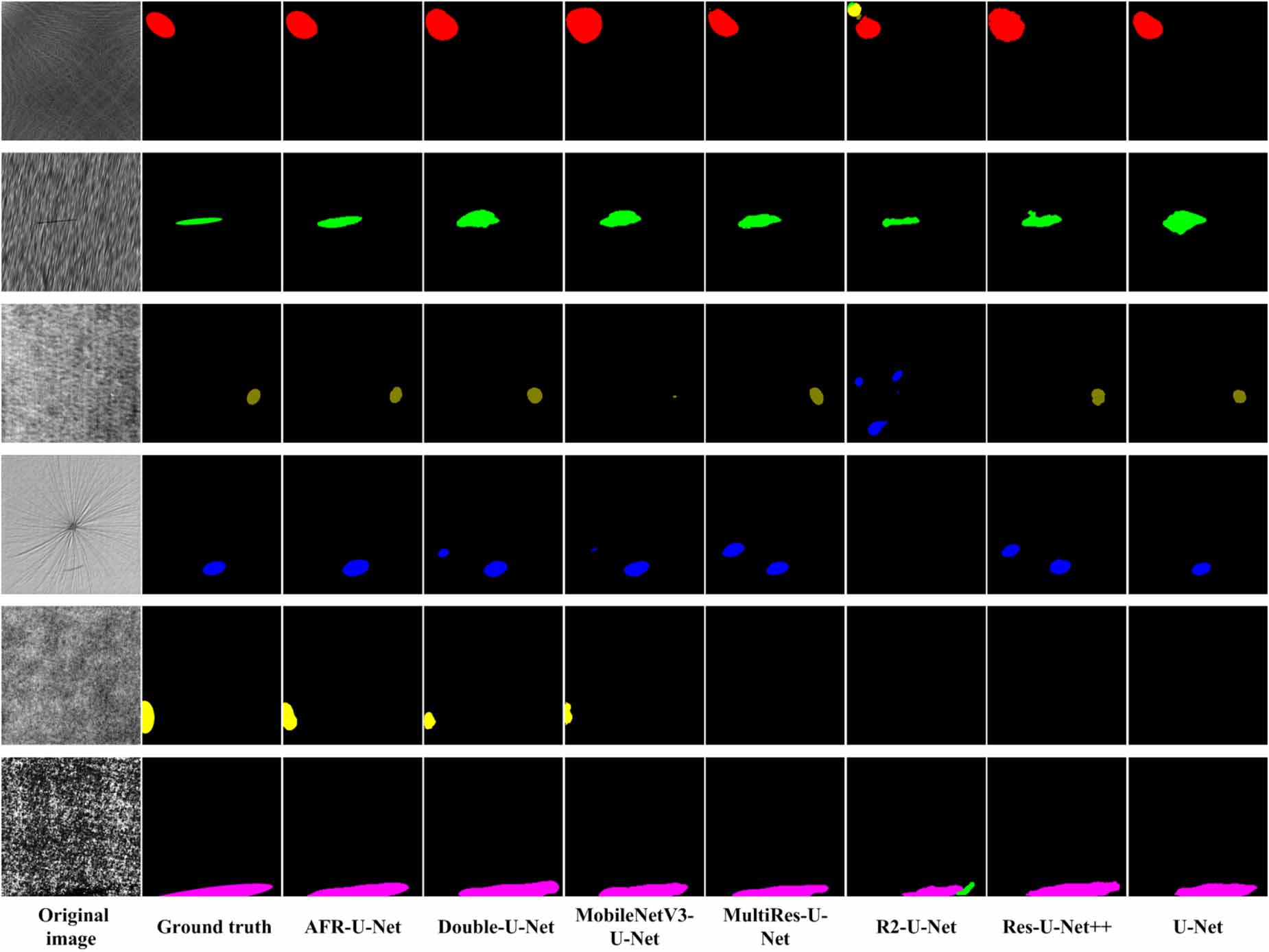 An adaptive feature refinement network for pixel-level segmentation of ...