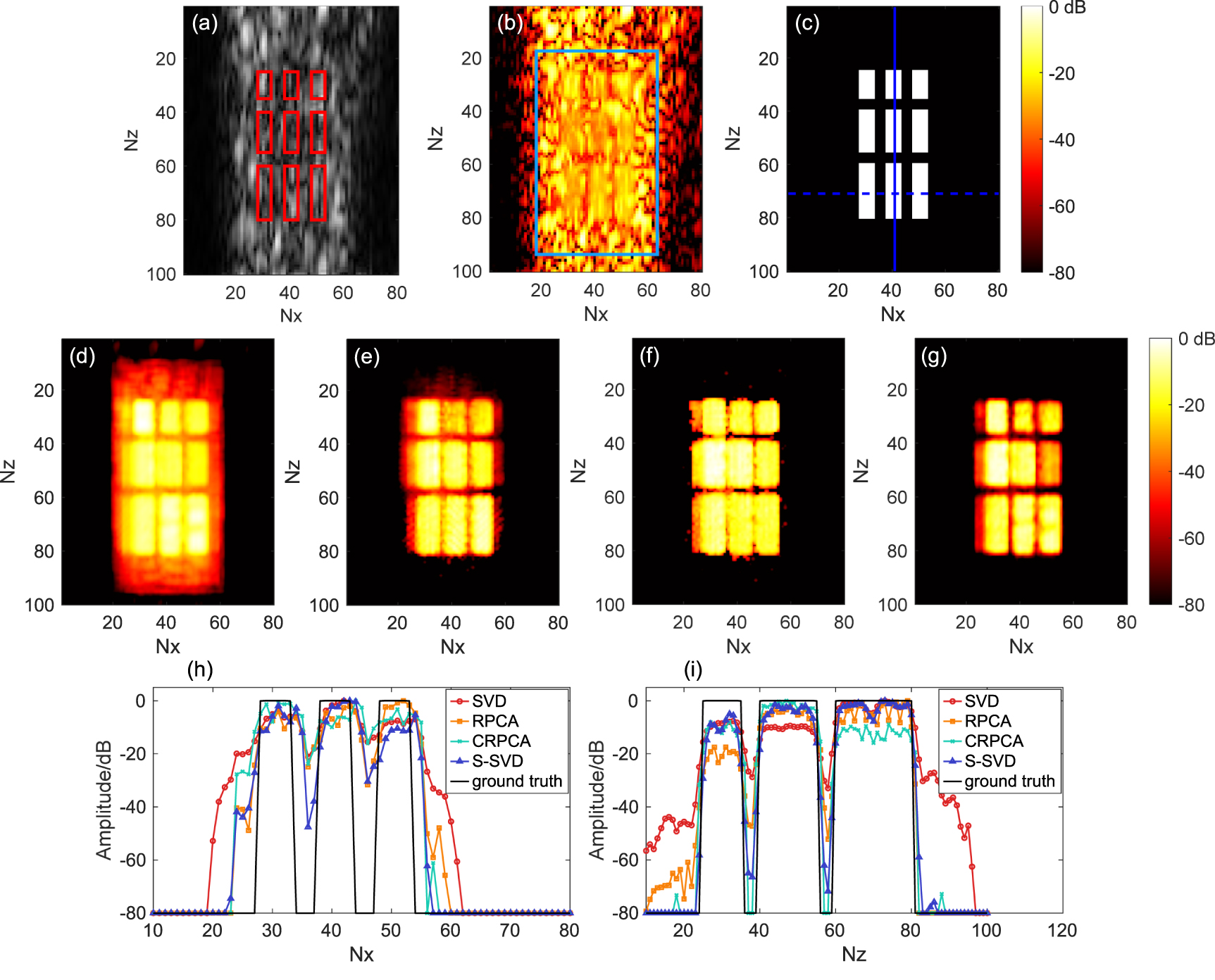 Sparse-SVD clutter filtering for ultrafast ultrasound cerebral vascular ...