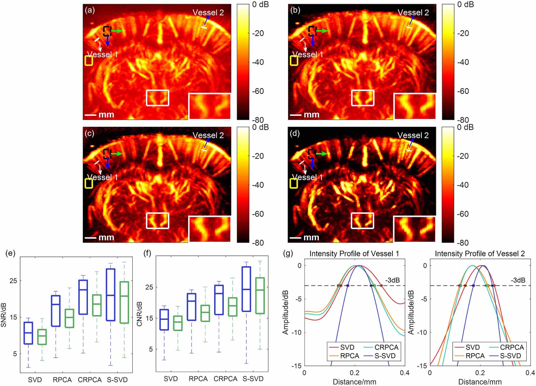 Sparse-SVD clutter filtering for ultrafast ultrasound cerebral vascular ...