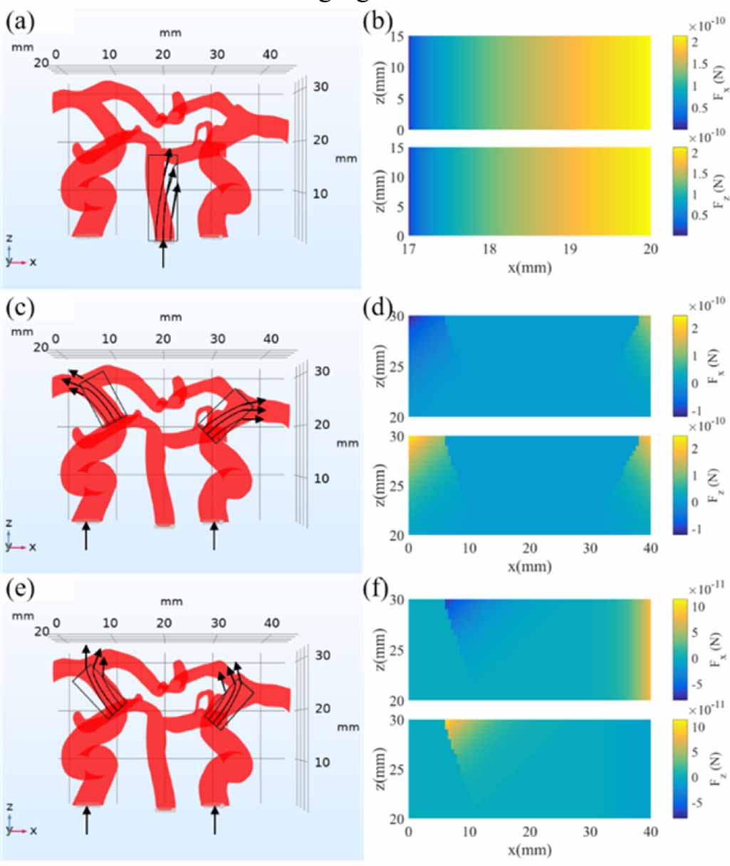 Personalized dynamic transport of magnetic nanorobots inside the brain ...