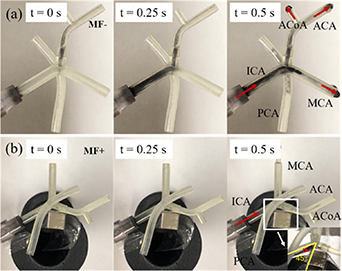 Personalized dynamic transport of magnetic nanorobots inside the brain ...