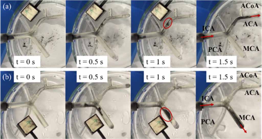 Personalized dynamic transport of magnetic nanorobots inside the brain ...