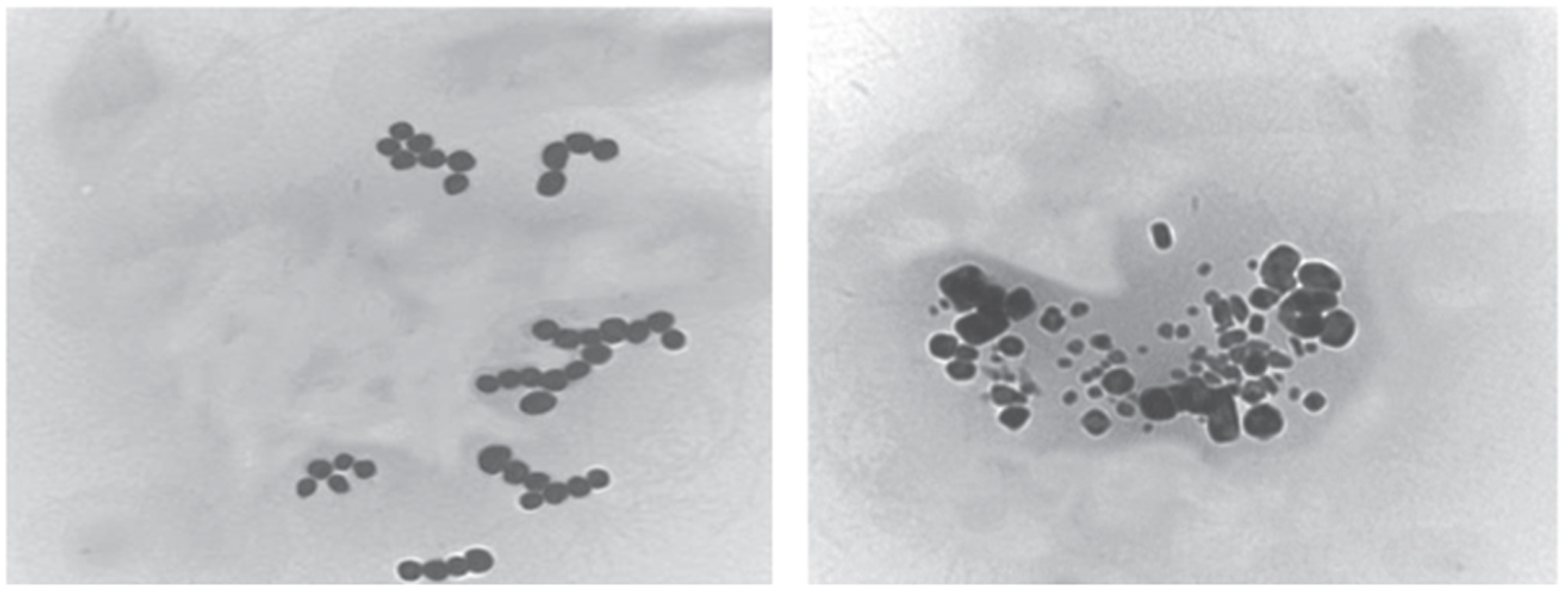 Effects of magnesium oxide and copper oxide nanoparticles on biofilm ...