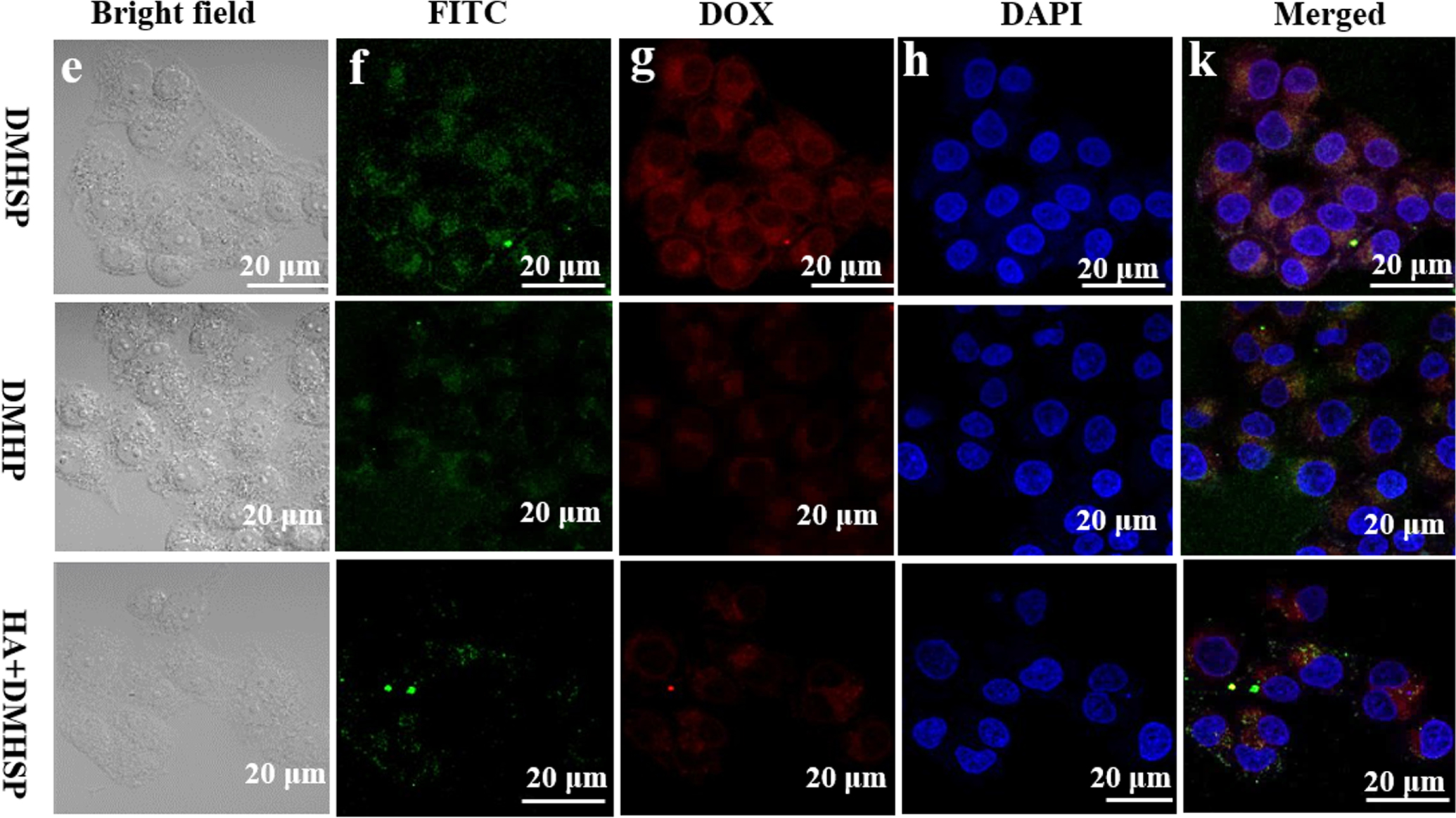 Preparation of multifunctional mesoporous SiO2 nanoparticles and anti ...