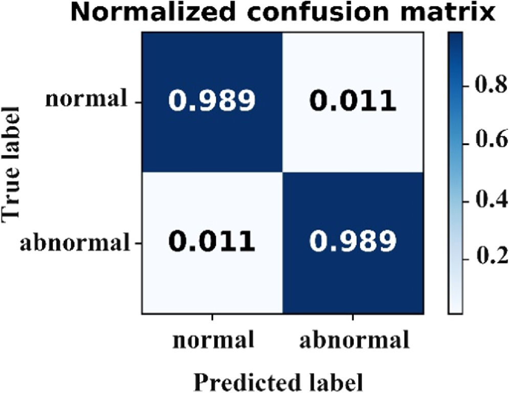 Design and application of a flexible nano cardiac sound sensor based on P(VDF-TrFE)/KNN/GR ...