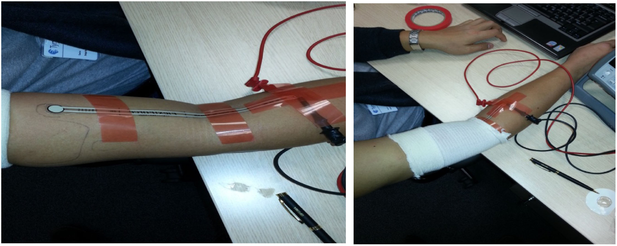 Design, fabrication and skin-electrode contact analysis of polymer ...