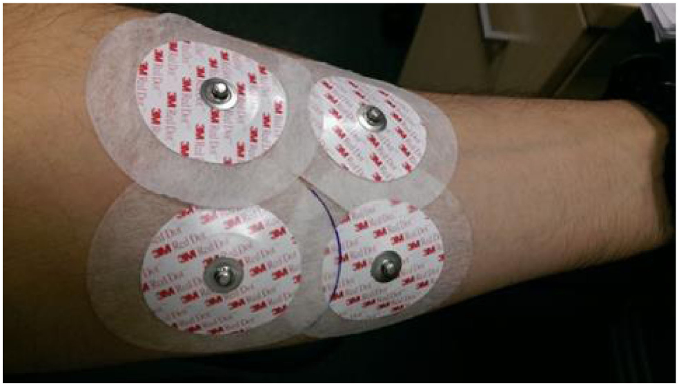 Design, fabrication and skin-electrode contact analysis of polymer ...