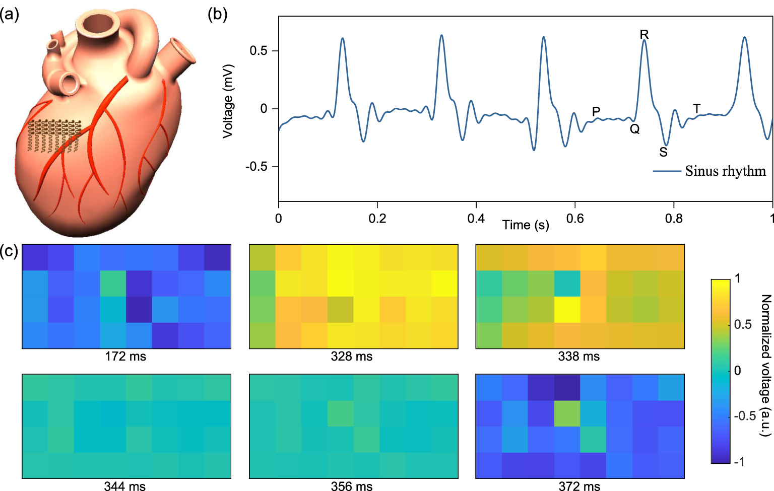 High-density stretchable microelectrode array based on multilayer ...