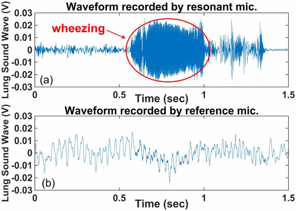 MEMS piezoelectric resonant microphone array for lung sound ...