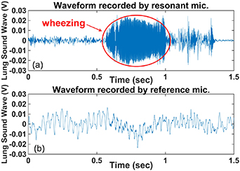 MEMS piezoelectric resonant microphone array for lung sound ...