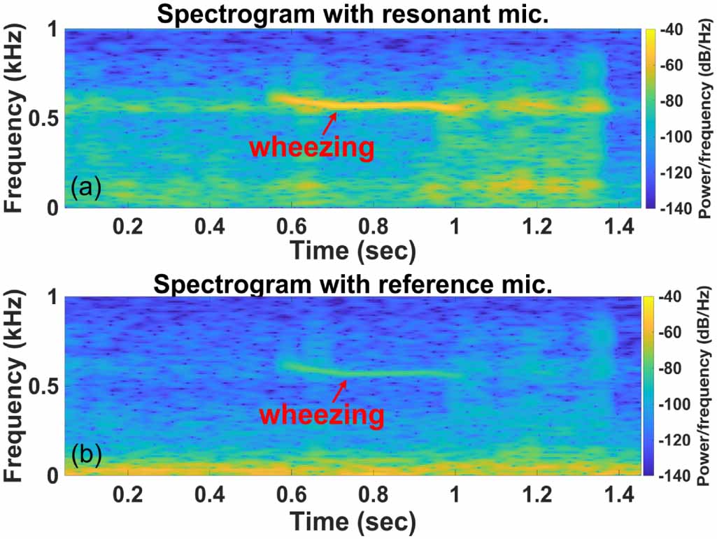 MEMS piezoelectric resonant microphone array for lung sound ...