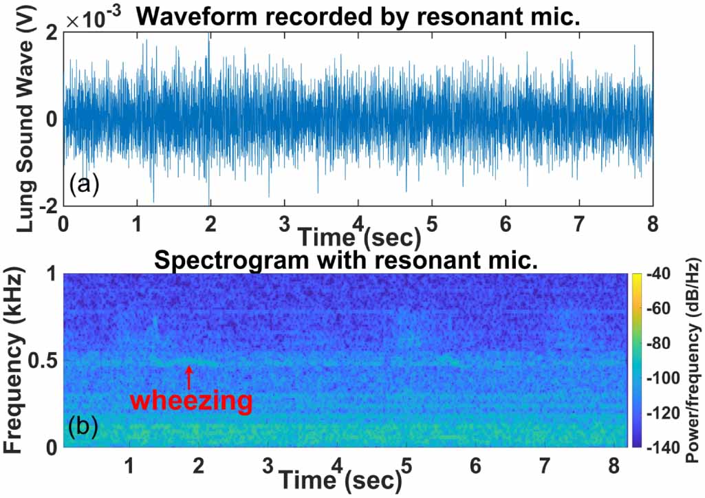 MEMS piezoelectric resonant microphone array for lung sound ...
